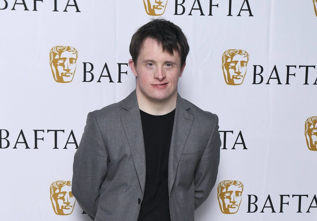 Breaking Down Barriers: Tommy Jessop Talks about his Journey | Spotlight